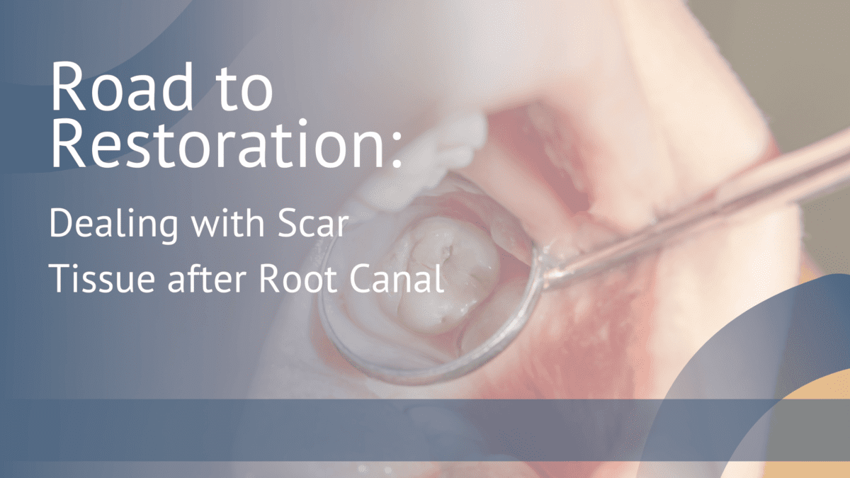 Road to Restoration: Dealing with Scar Tissue after Root Canal