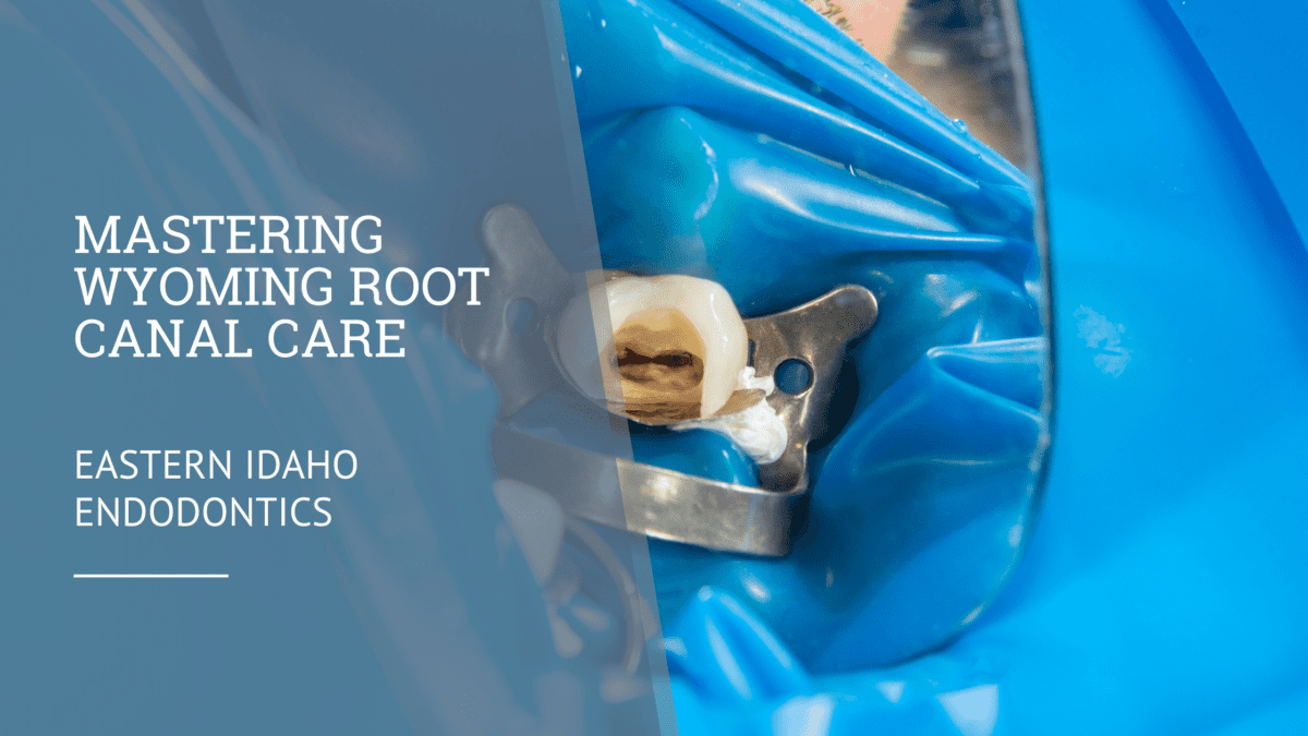 Mastering Wyoming Root Canal Care - Eastern Idaho Endodontics