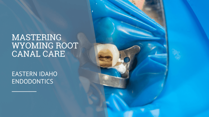 Mastering Wyoming Root Canal Care - Eastern Idaho Endodontics