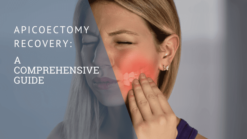 Apicoectomy Recovery: A Comprehensive Guide - Eastern Idaho Endodontics