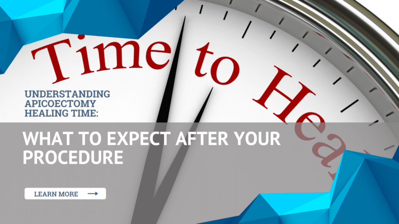 Understanding Apicoectomy Healing Time: What to Expect After Your ...