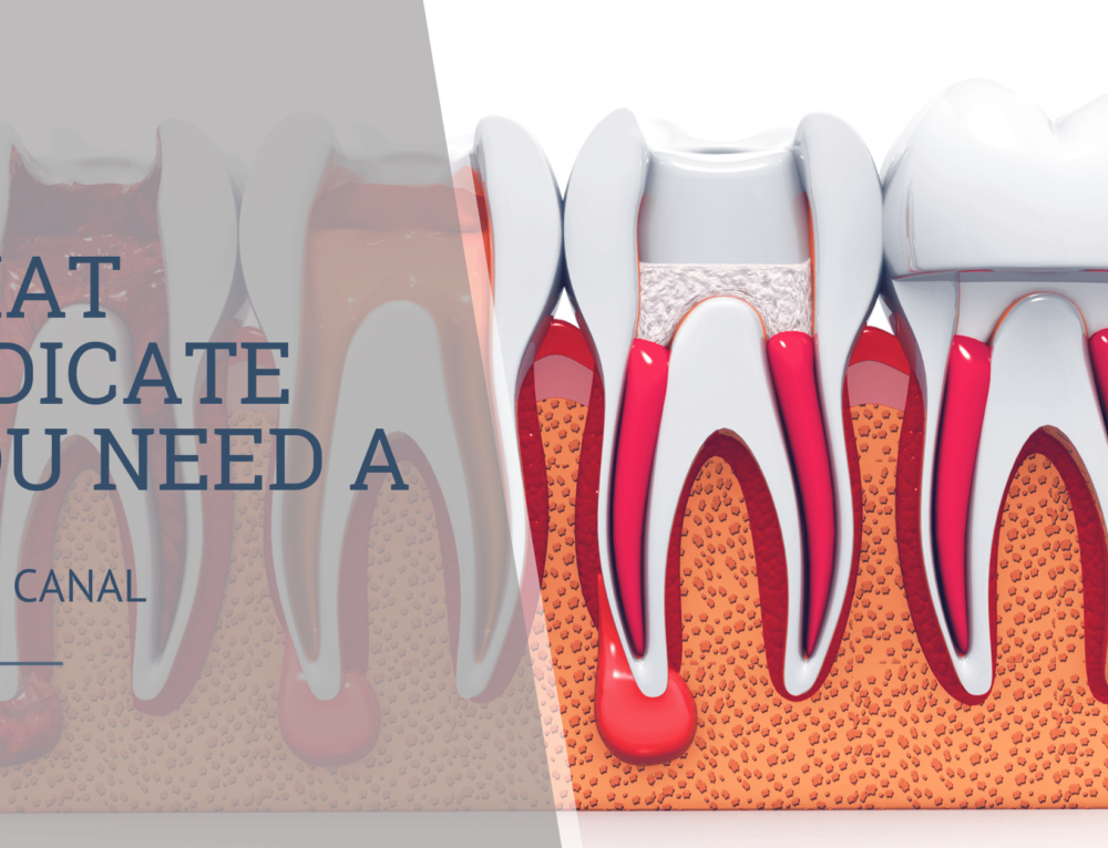 Road to Restoration: Dealing with Scar Tissue after Root Canal