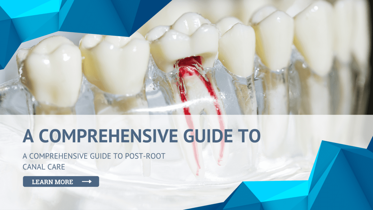 A Comprehensive Guide to Post-Root Canal Care - Eastern Idaho Endodontics