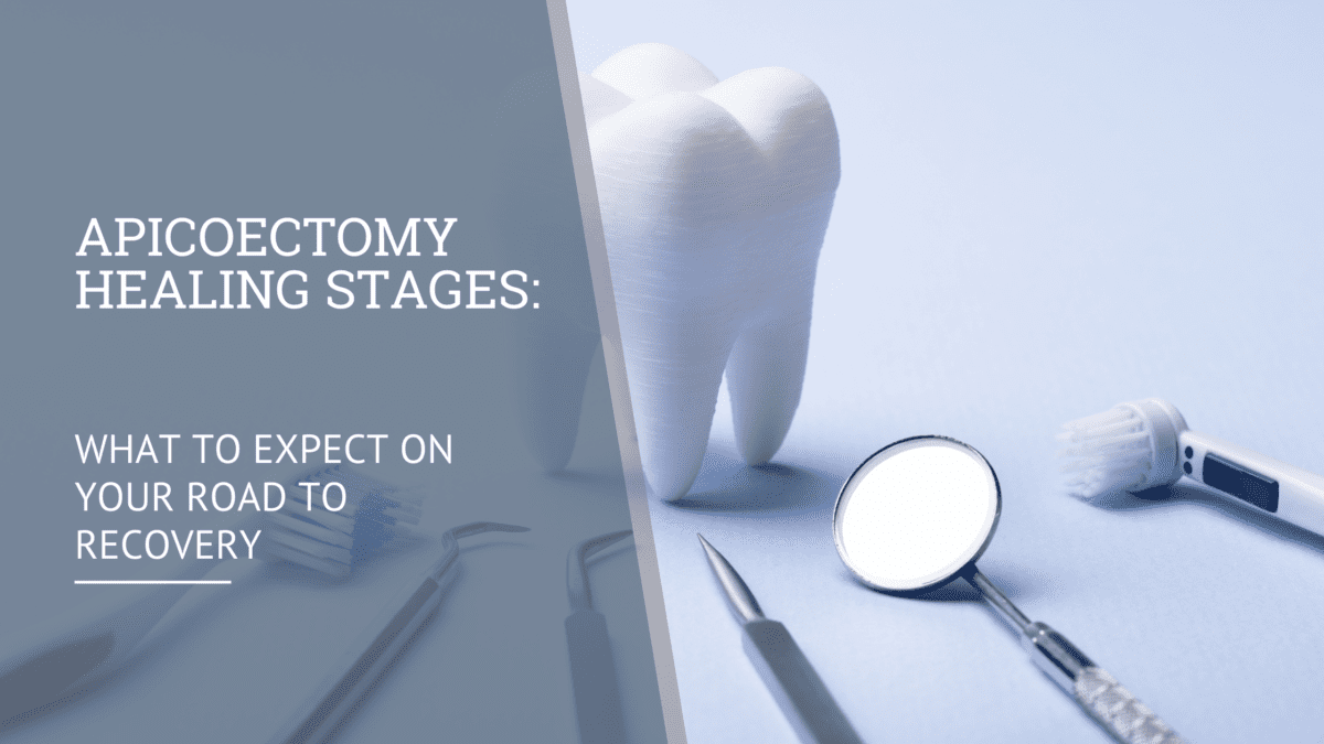 Apicoectomy Healing Stages:Recovery Guide | Eastern Idaho Endo