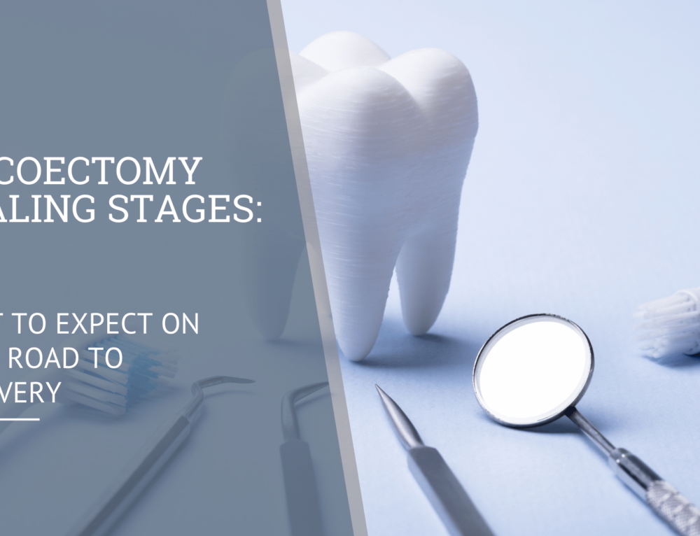 Understanding Apicoectomy Healing Time: What to Expect After Your ...