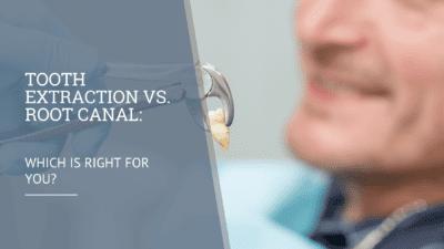Tooth Extraction vs. Root Canal: Which is Right for You? - Eastern ...