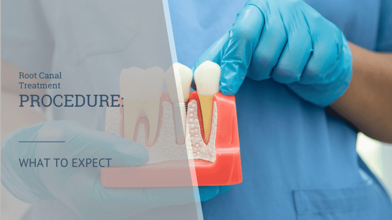 Root Canal Treatment Procedure: What to Expect - Eastern Idaho Endodontics
