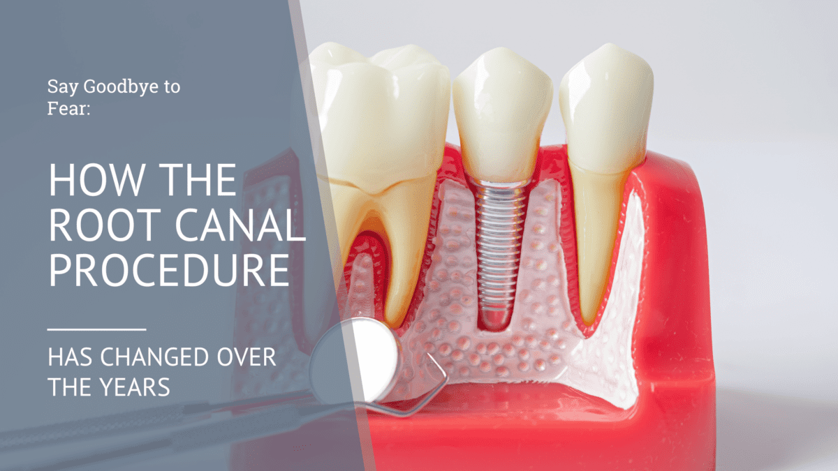 Say Goodbye to Root Canal Procedure Fear: Things Have Change