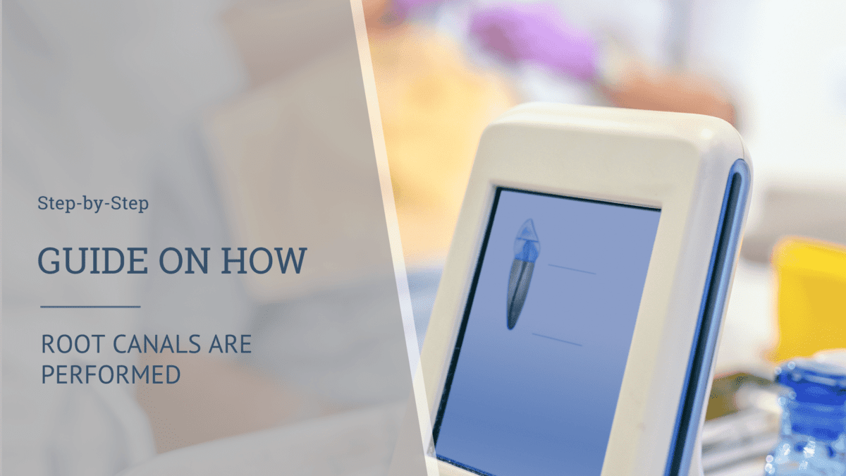 Step-by-Step Guide to How Root Canals Are Performed - Eastern Idaho Endodontics