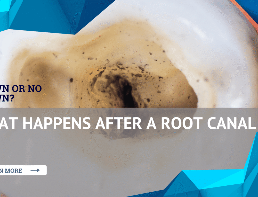 Swelling After a Root Canal? Here’s What It Could Mean - Eastern Idaho ...