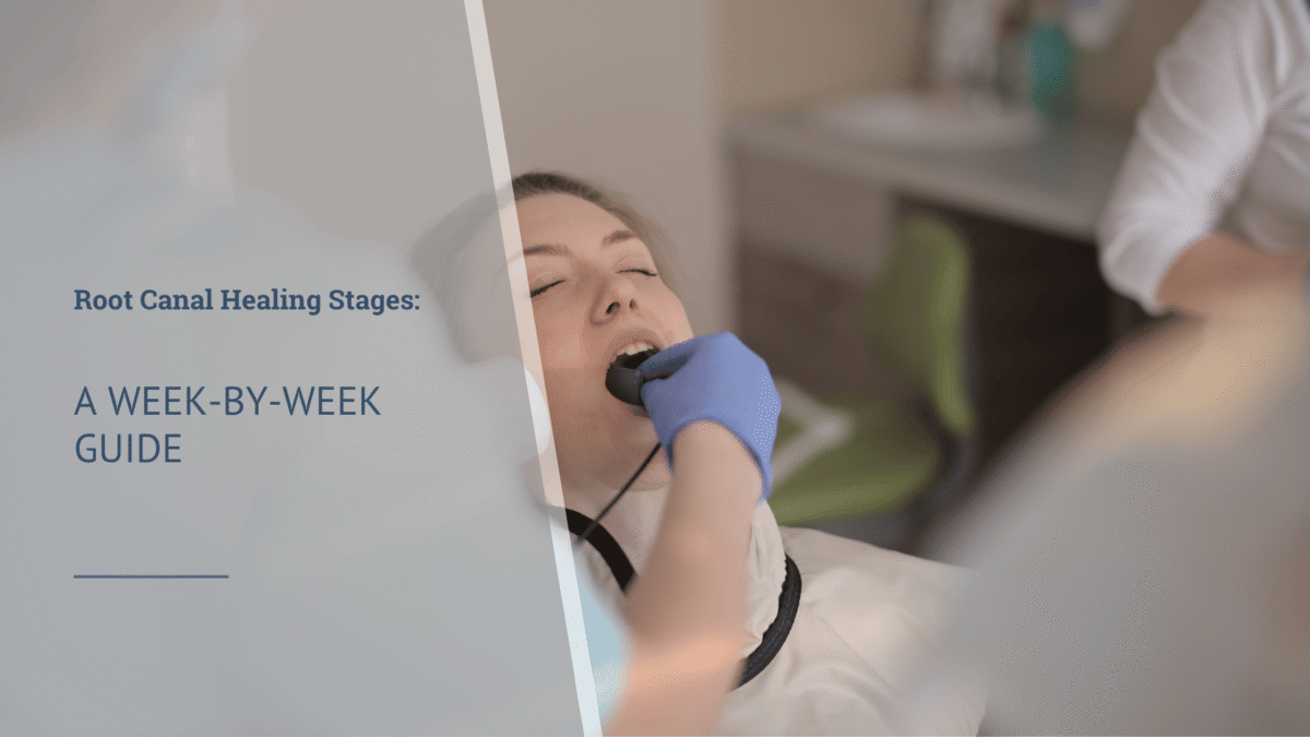 Root Canal Healing Stages: A Week-by-Week Guide - Eastern Idaho Endodontics