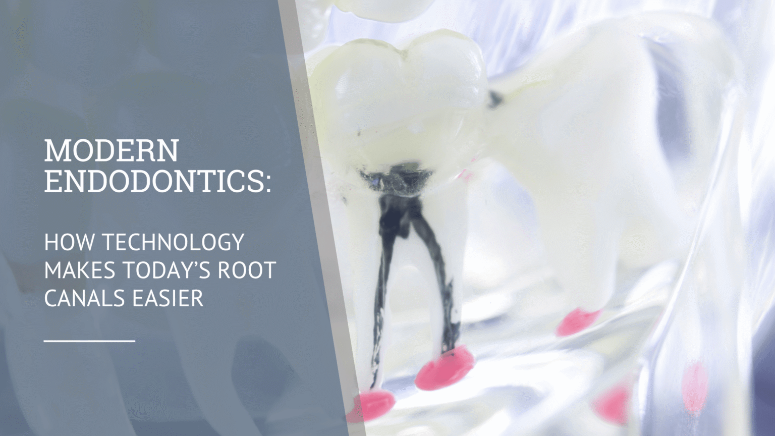 3D imaging root canal Archives - Eastern Idaho Endodontics