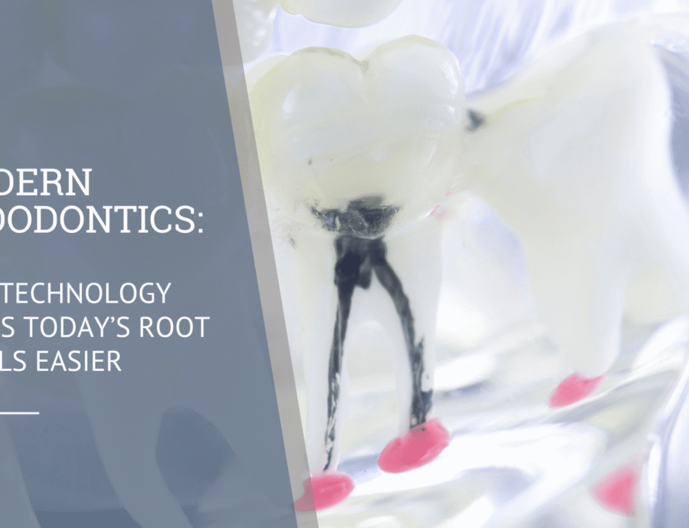 Crown or No Crown? What Happens After a Root Canal - Eastern Idaho Endodontics