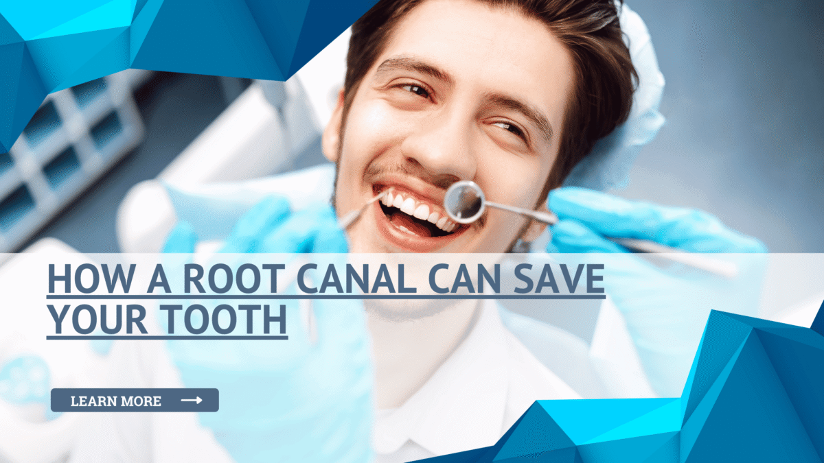 How a Root Canal Can Save Your Tooth—and Your Smile - Eastern Idaho ...