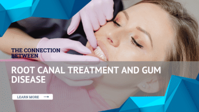 The Connection Between Root Canal Treatment and Gum Disease - Eastern ...