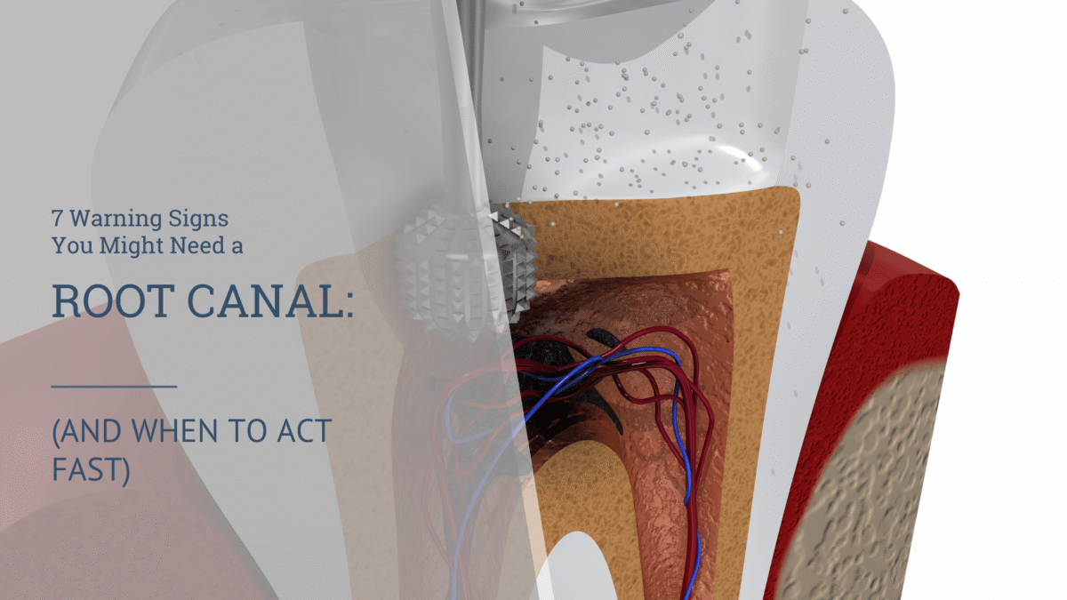 7 Signs You Need a Root Canal | Eastern Idaho Endodontics