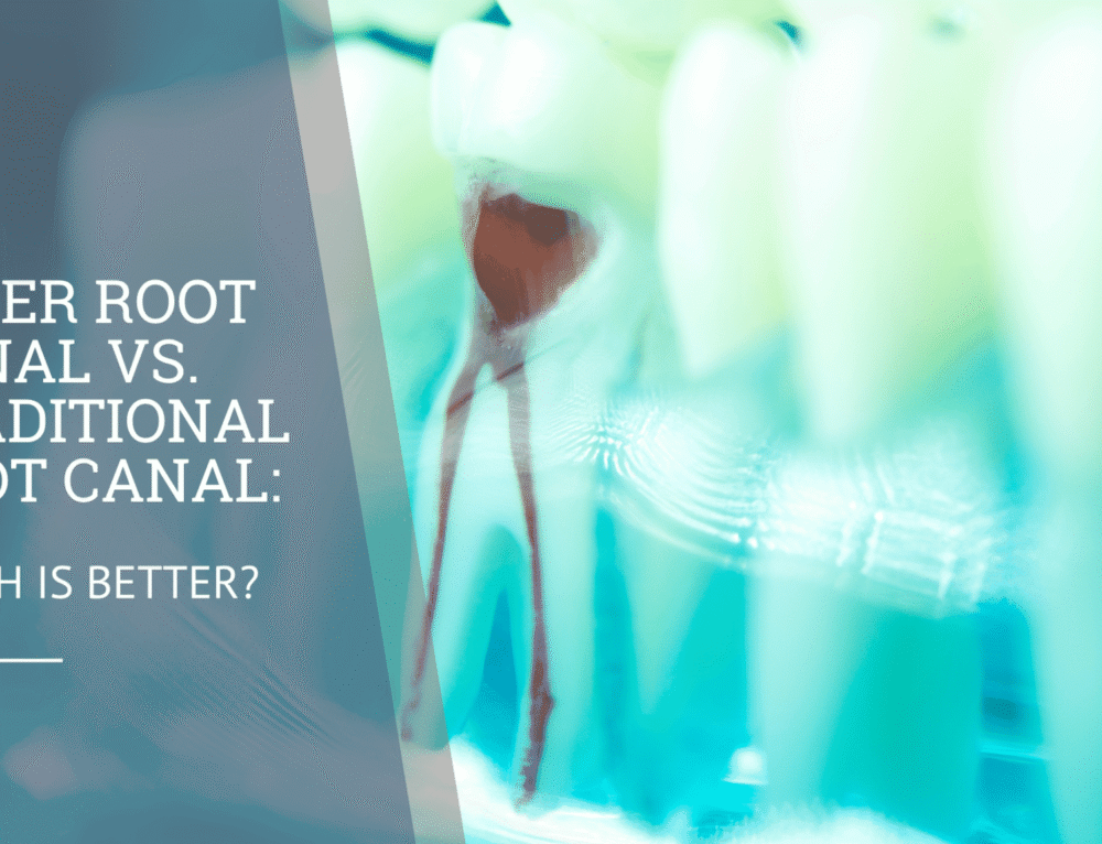 Root Canal Healing Stages: What to Expect After Treatment - Eastern Idaho Endodontics