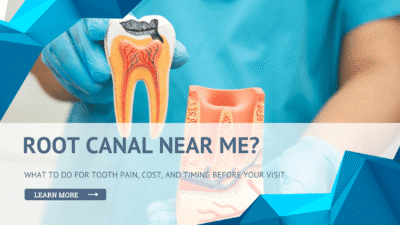 Root Canal Near Me? Tooth Pain Relief, Cost & What to Expect