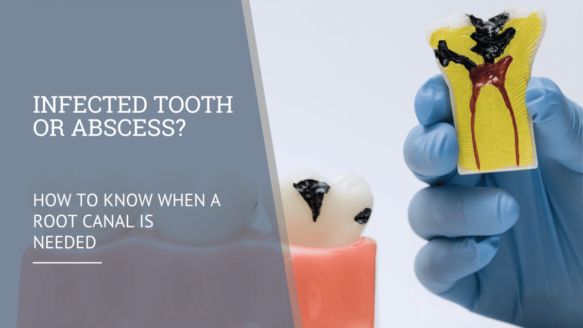 Infected Tooth or Abscess? Signs You May Need a Root Canal