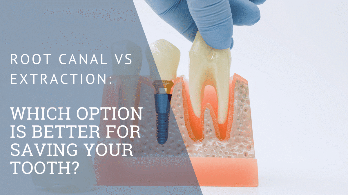 Root Canal vs Extraction: Which Option Is Better for Your Tooth?